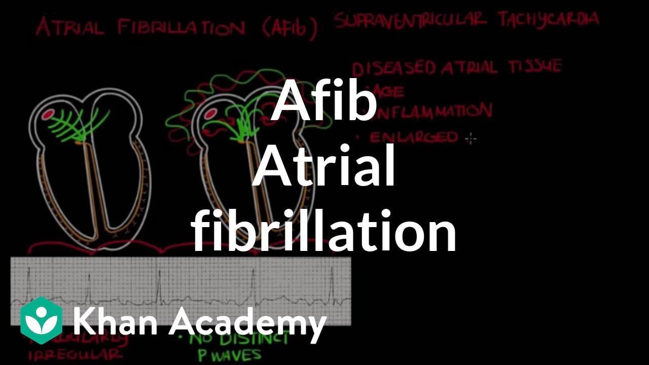 Atrial fibrillation | sankofaonline.com